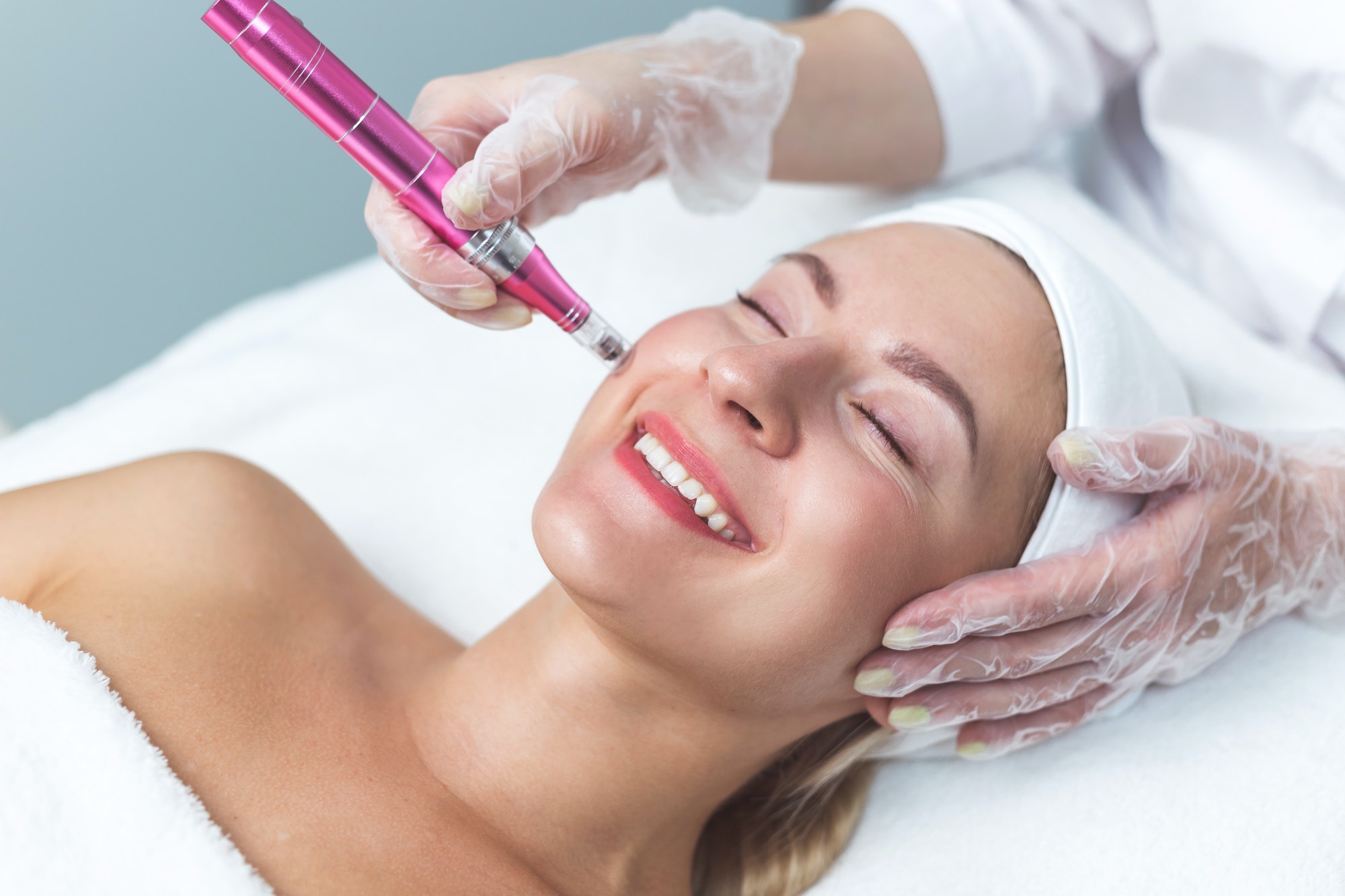Skin Needling - The Skin Studio Littleborough